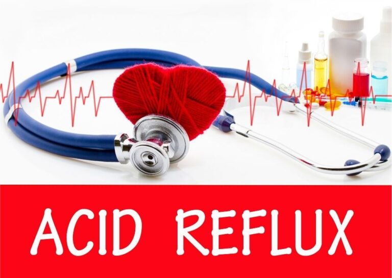 Sodium Alginate for Acid Reflux: A Natural Solution for GERD Relief
